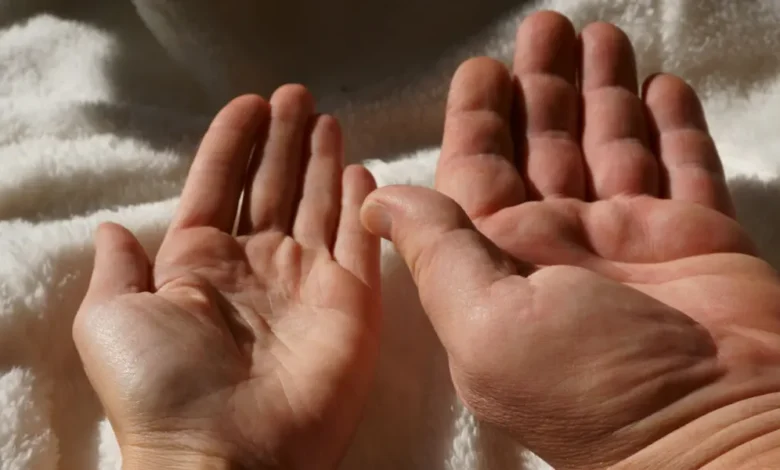 Akromegalija - "stranac" u ogledalu i ozbiljne komplikacije - kme ...